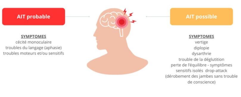 Fiche IDE : l'Accident Vasculaire Cérébral (AVC)